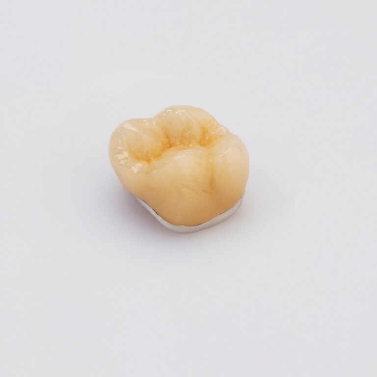 Crowns & Bridges Archives - Andent - Andent Dental Laboratory