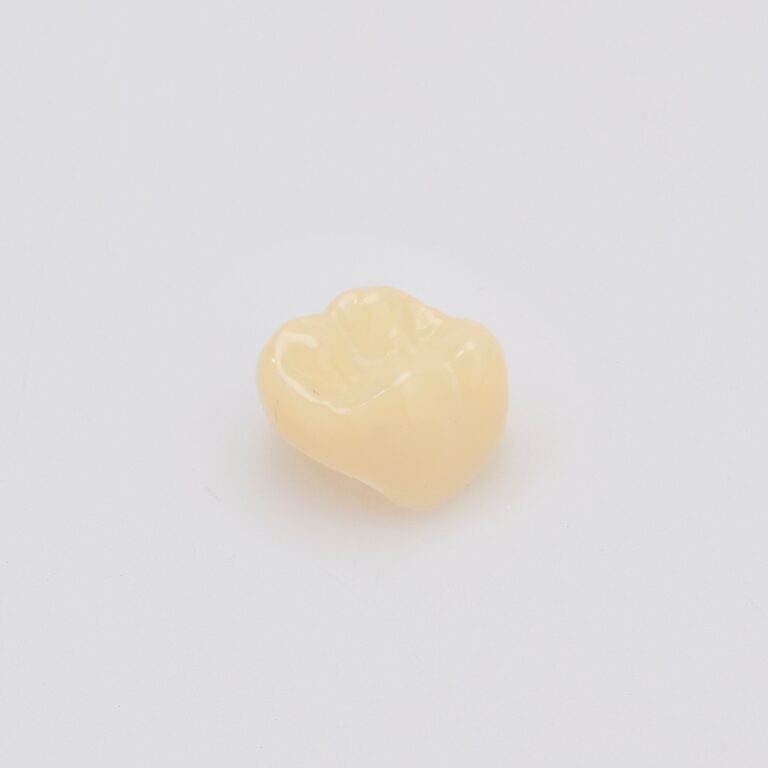 PMMA Temporary Crown - Andent - Andent Dental Laboratory