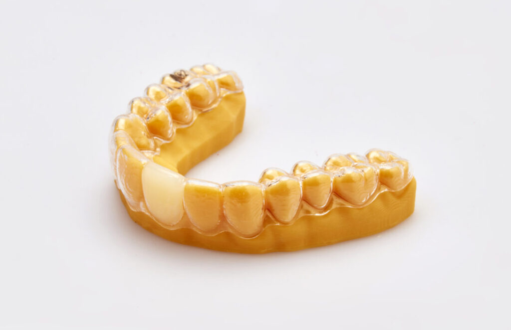Temporary Crown Vacuum Shell - Andent - Andent Dental Laboratory