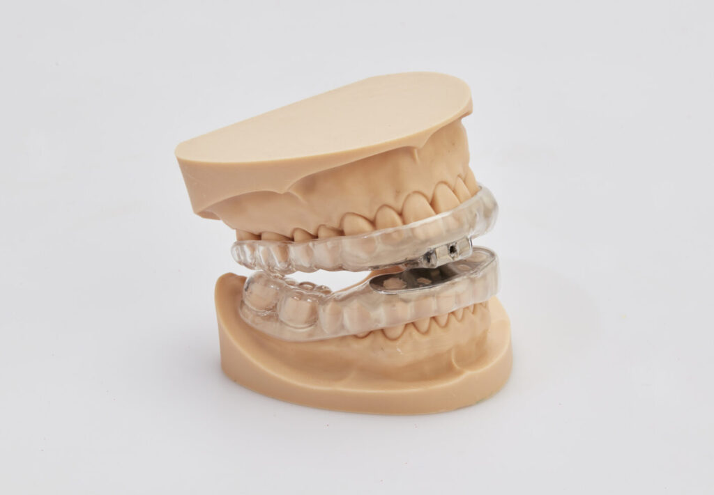 Snore Appliance - Andent - Andent Dental Laboratory