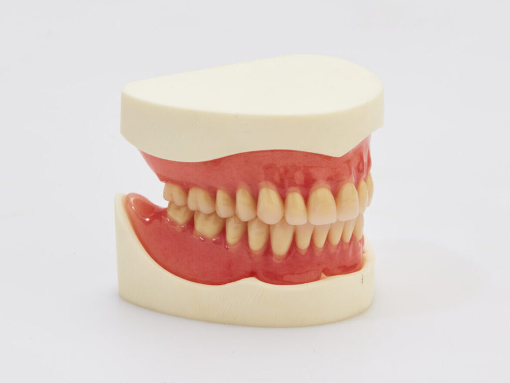 Nylon Splint - Andent - Andent Dental Laboratory