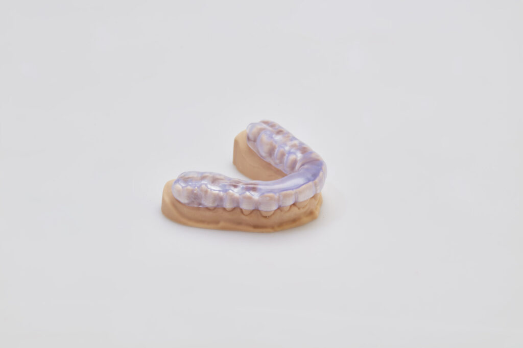 Premium Splint (Digitally Made) - Andent - Andent Dental Laboratory