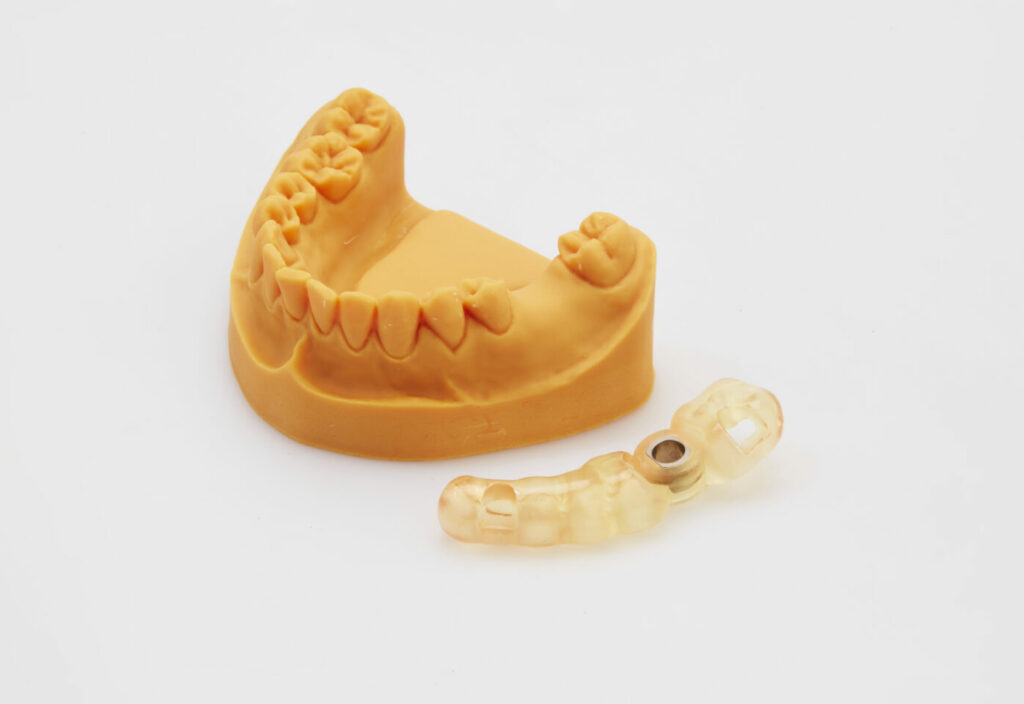 Nylon Splint - Andent - Andent Dental Laboratory
